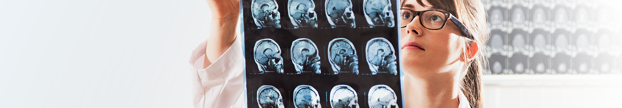 Head & Neck Injury Attorneys | Columbus GA & Phenix City AL